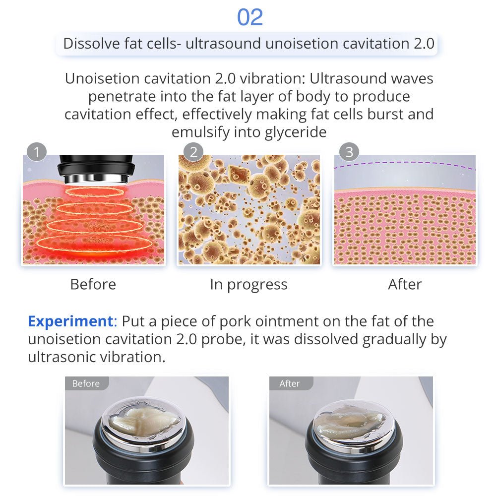 Shape Tactics 5-in-1 Unoisetion Ultrasonic RF Cavitation Weight Loss M