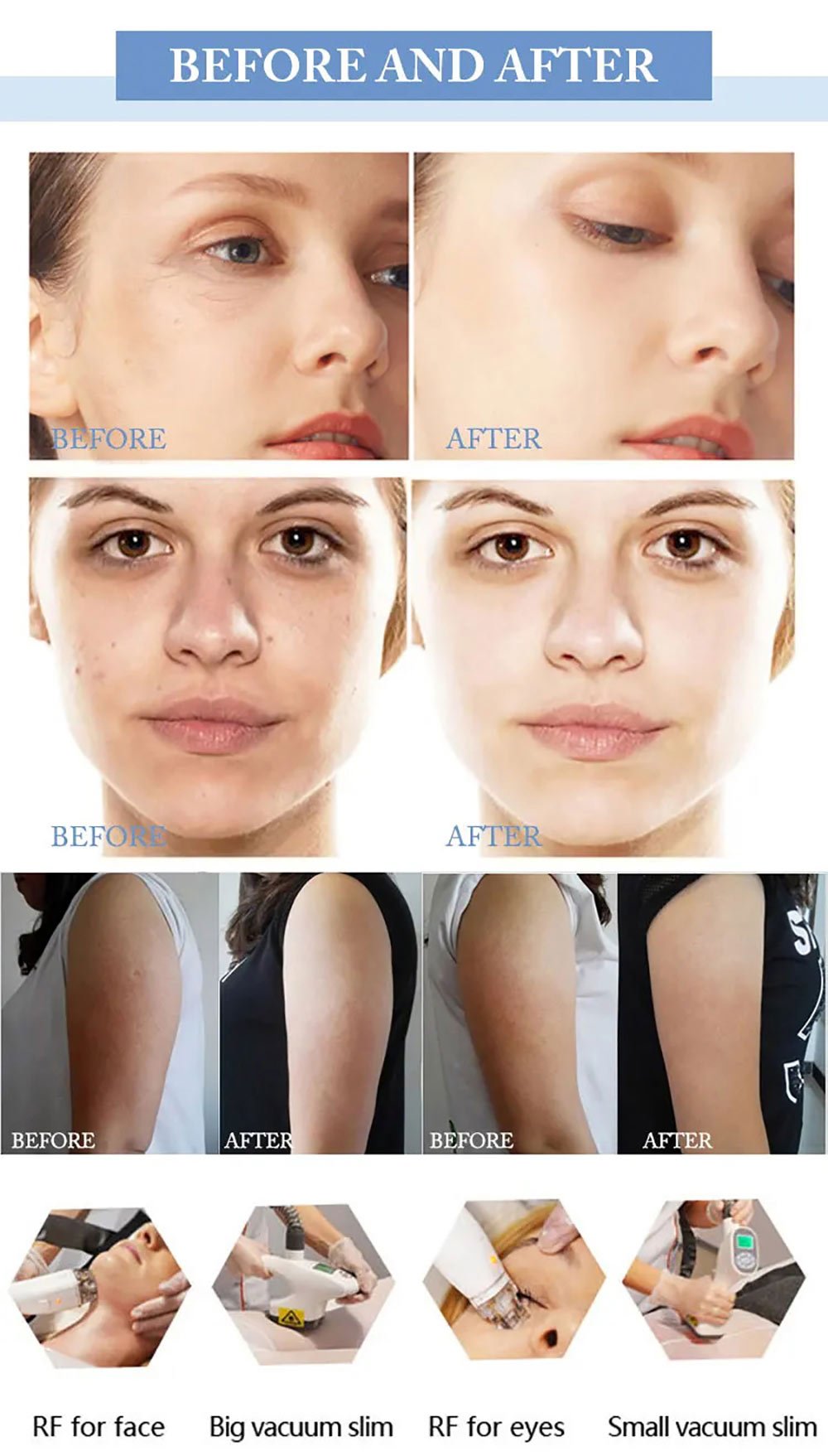 Shape Tactics Advanced Body Sculpting Negative Pressure and Inner Ball