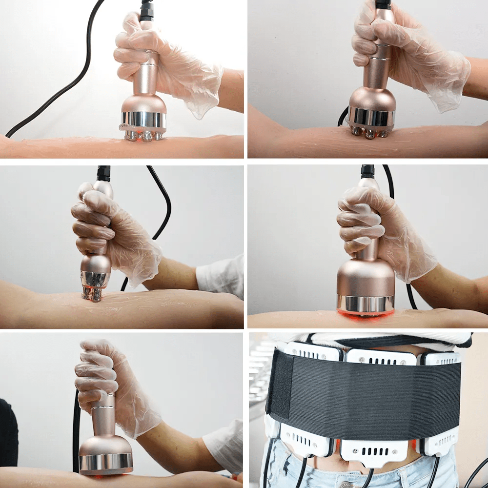 Shape Tactics - ProElite 40K RF Lipo Laser System | Wellbots