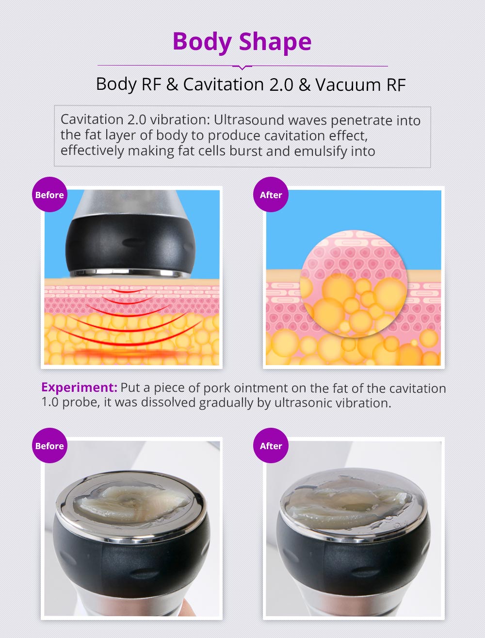 Shape Tactics - Unoisetion 40k Cavitation Ultrasound RF Multipolar ...